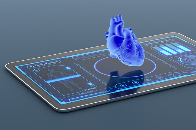 Outsource Cardiac PET/CT Reporting Services - USA, Europe